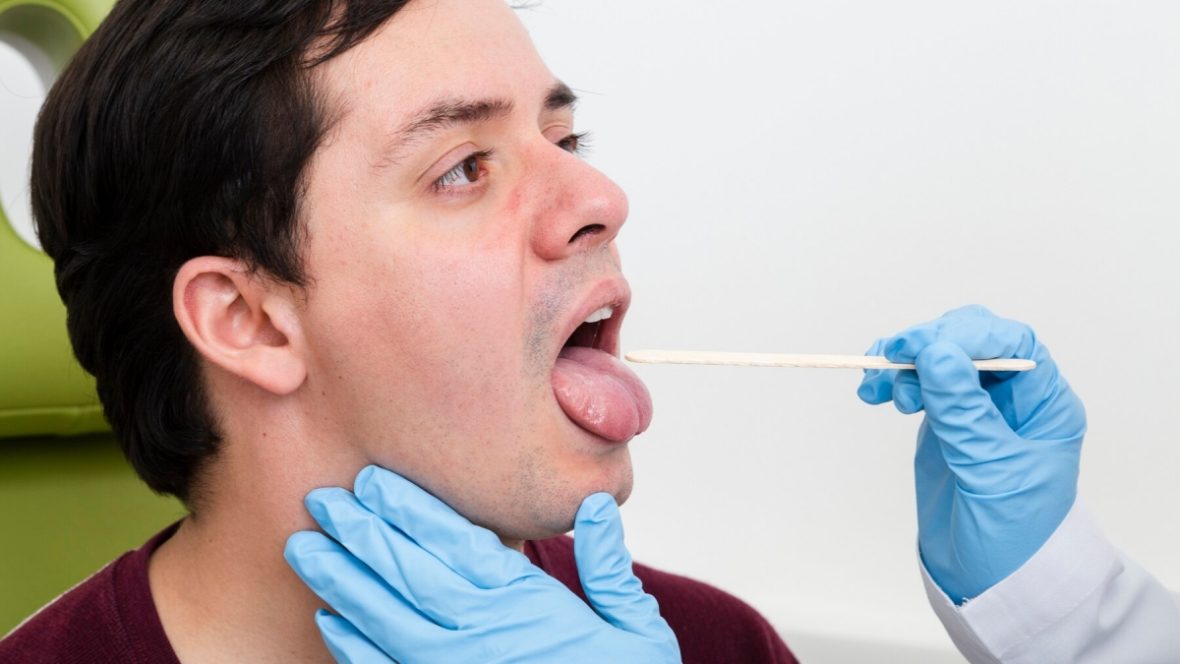 PERSISTENT SORE THROAT: IS IT ALWAYS TONSILLITIS? | Omega Underground